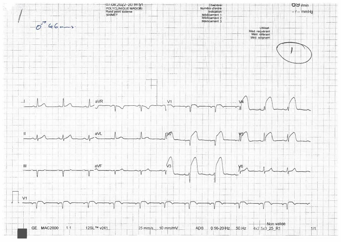 Coup de cœur pour un myocarde en souffrance - Medic' Air International